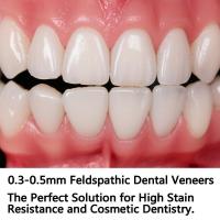 China 0.3-0.5mm Feldspathic Dental Veneers with 16 Shades and Long-lasting Durability for Cosmetic Dentistry for sale