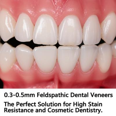 China 0.3-0.5mm Feldspathic Dental Veneers with 16 Shades and Long-lasting Durability for Cosmetic Dentistry for sale