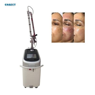 China 532nm 1064nm Pico Laser  tattoo removal q switched Nd Yag Laser Machine Freckles Remover q switch nd yag laser machine for sale