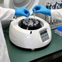 China 15000rpm Mini Centrifuge Machine Customizable Small Lab Centrifuge Low Noise For DNA, RNA And Blood Samples for sale
