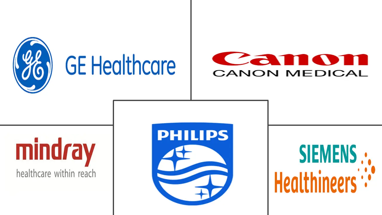 Ultrasound Devices Market Major Players