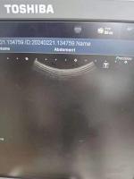 China Toshiba convex array original ultrasound probe PVU-375BT ultrasonic transducer for sale