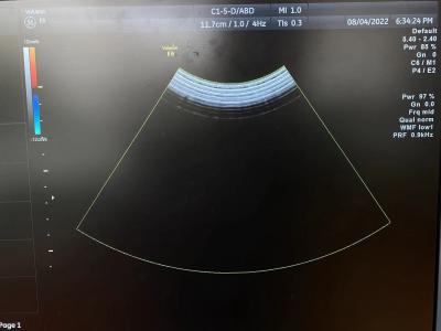 China GE Logiq S7 Convex Array Original Ultrasound Transducer Probe C1-5-D for sale