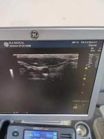 China Original Linear Array Ultrasound Machine Probes ML6-15 For GE LogiqP6 Ultrasound for sale