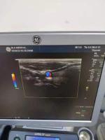 China Original Linear Array Ultrasound Machine Probes ML6-15 For GE LogiqP6 Ultrasound for sale