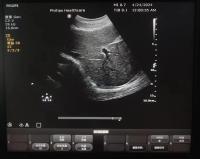 China ATL Clearvue original convex array ultrasound probe C5-2 for sale