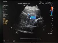 China ATL Clearvue original convex array ultrasound probe C5-2 for sale