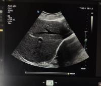 China ATL EPIQ7 new original convex array ultrasound probe C5-1 for sale
