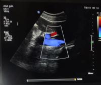 China ATL EPIQ7 new original convex array ultrasound probe C5-1 for sale
