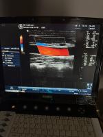 China Original Portable Ultrasound Scan Machine , GE Logiq E Medical Ultrasound Equipment for sale
