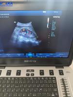 China Mindray Laptop Original Ultrasound System M9 Curved array for sale