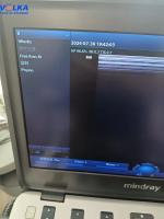 China Mindray Laptop Original Ultrasound System M9 Curved array for sale
