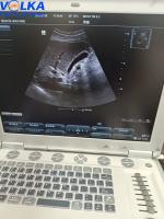 China Mindray Portable Original Ultrasound System M7 Real-time 3D imaging for sale