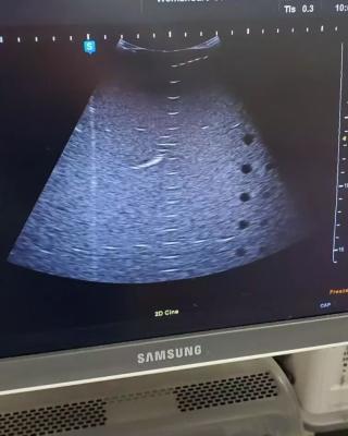 China Samsung Medison H60 Convex Array Original Ultrasound Probe CF2-8 for sale