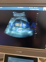 China Trolley Color Doppler Vascular Ultrasound SonoScape S40 for sale