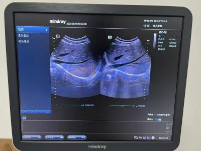 China Repair Mindray C5-2E DC-70 Convex OB/GYN Probe C5-2E for sale