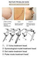 China 60W Fractional CO2 Laser Equipment for Scar Removal and Skin Rejuvenation 10600nm for sale