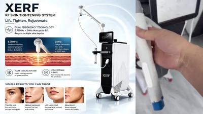 China Aesthetic Clinic XERF Dual Frequency 6.78MHz Painless Skin Tightening SMAS Face Lift Collagen Boost OEM for sale