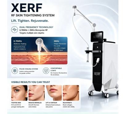 China XERF Dual Frequency RF Skin Tightening Machine 6.78MHz & 2MHz Monopolar RF Anti-Aging Device XERF Machine for Skin Tightening for sale
