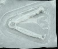 China 5cm Plastic Umbilical Cord Clamp Disposable Newborn Umbilical Cord Clamp for sale