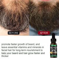 China Men Beard Care Growth Oil 60ML 100ML Custom Logo Moisturizing Nourishing Hair Oil for sale