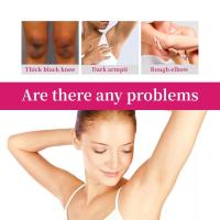 China Private Label Skin Whitening Yoni Lightening Cream 60ml 100ml 200ml OEM for sale