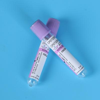 China EDTA K2 Lavender Top Blood Collection Tube 1ml-10ml Vacuum Routine Tube for Hematology for sale