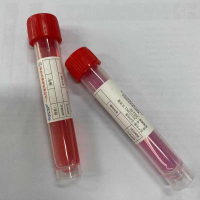 China Flocked Naopharyngeal Virus Collection Sampling Tube - Medical Disposable Transport with 1.2M Daily Capacity for sale