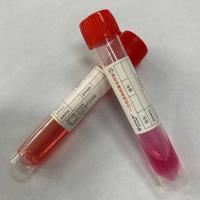China Mixed Disposable Virus Sampling Tube COVID-19 Test Plastic B-12.0 with Multiple Model Options for sale