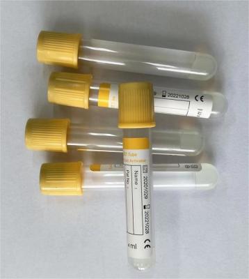 China Medical Vacuum Blood Collection Tube 2-10ml Gel Tube Yellow Top SST Clot Activator for sale
