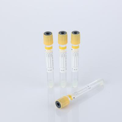 China Yellow Top SST Vacuum Blood Collection Tube 1-10ml Gel Clot Activator for Biochemical Tests for sale