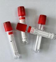 China Plain Vacuum Blood Collection Tube 1ml-10ml 13x75mm Smooth Inner Wall Prevents Cell Attachment for sale