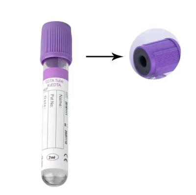 China EDTA Vacuum Blood Collection Tube 2ml 3ml 5ml 10ml K2 K3 Anticoagulant for Plasma Samples for sale