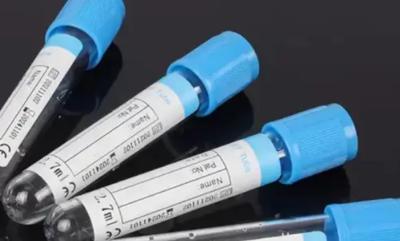 China Light Blue Top Coagulation Tube 3.2% Sodium Citrate 9:1 Blood Ratio Vacuum Blood Collection Tube 1-10ml for sale