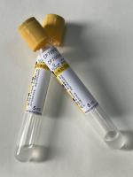 China OEM Custom Serum Separator Tube SST 3ml-10ml with Clot Activator Gel Barrier Yellow Top for sale