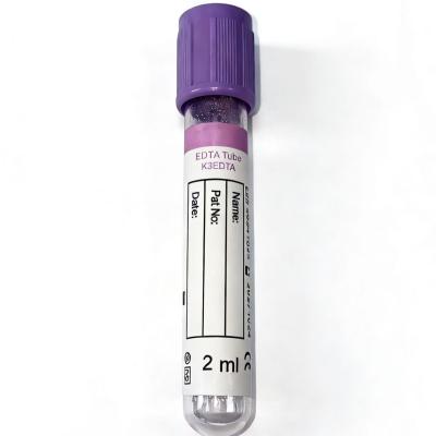 China Whole Blood EDTA Tubes: Essential for Hematology & Molecular Test Integrity for sale
