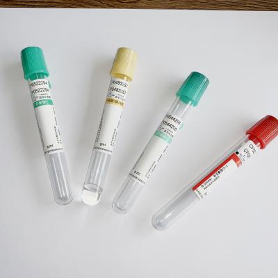 China Laboratory Vacuum Blood Collection System with Gel & Clot Activator Tubes 1-10ml Capacity Custom Logo Options for sale