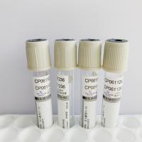 China Glucose Vacuum Blood Collection Tubes 1-6ml with EDTA/Sodium Fluoride for Blood Sugar Testing for sale