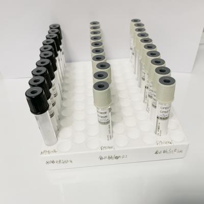 China Sterile Red Top Blood Collection Tubes with Clot Activator - CE & ISO 13485 Certified - 500,000 Monthly Capacity for sale
