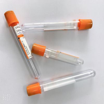 China PP Glass PET Blood Test Tube with Clot Activator 4ml 5ml for Hospital Serum Collection and Diagnostic Testing for sale