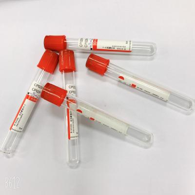 China 5ml Leakage Proof Serum Separator Tubes - Red Cap Safety Closure for Biochemistry Lab Testing for sale