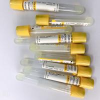 China Medical Gel Clot Activator Tubes 3ml 5ml 10ml with Accurate Vacuum Draw for Laboratory Testing for sale