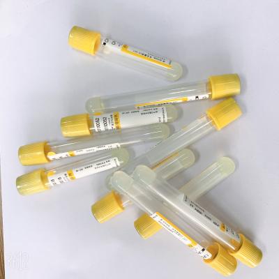 China Yellow Top Blood Collection Tubes with Gel & Clot Activator - 1-6ml Capacity in Glass/PET Materials for sale