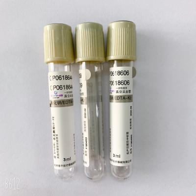 China Evacuated Vacuum Blood Collection Tube for Glucose Tolerance Test - 2ml to 6ml Capacity, 3500-4000 RPM Centrifugation for sale