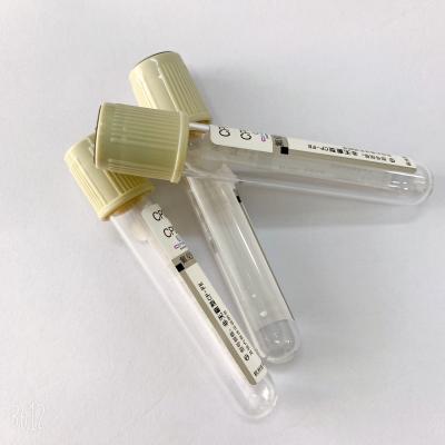 China Disposable Glucose Blood Collection Tubes with Sodium Fluoride Potassium Oxalate - 2ml to 6ml Capacity, 3500-4000 RPM Centrifugation for sale