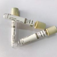 China Glucose Blood Collection Tubes 1-6ml with Sodium Fluoride Additive for Plasma Testing - Grey Cap Vacuum Tubes for sale