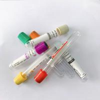China Green Top Lithium Heparin Vacuum Blood Collection Tube - 13x75mm, 13*100mm, 16x100mm Sizes for Plasma Testing for sale