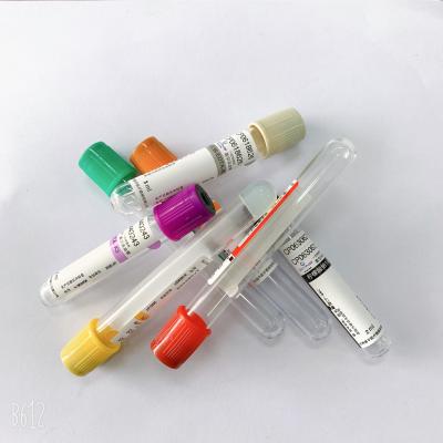 China Green Top Lithium Heparin Vacuum Blood Collection Tube - 13x75mm, 13*100mm, 16x100mm Sizes for Plasma Testing for sale
