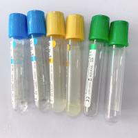 China ESR Citrate Blood Collection Tube 8×120mm Micro SST Phlebotomy Tube with 2-10ml Capacity for sale