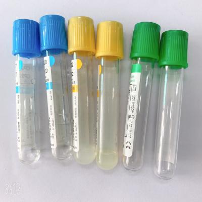 China ESR Citrate Blood Collection Tube 8×120mm Micro SST Phlebotomy Tube with 2-10ml Capacity for sale